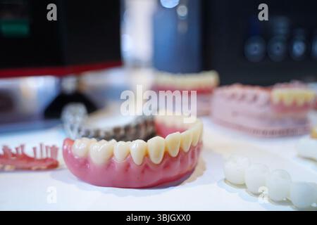 Mouth guard with teeth. Dental exhibition Stock Photo - Alamy