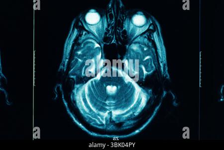 sharp ct scan of the human brain Stock Photo - Alamy