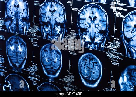 A group of CAT scans of the human brain closeup Stock Photo - Alamy
