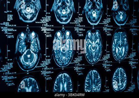A group of CAT scans of the human brain closeup Stock Photo - Alamy
