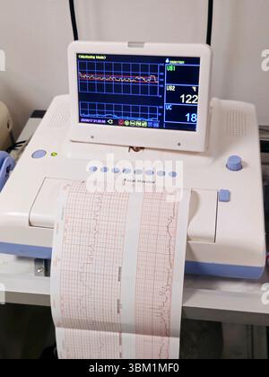 Cardiotocography device placed on mother's abdomen recording the fetal ...