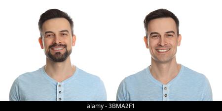 Handsome man before and after shaving on white background, collage of ...