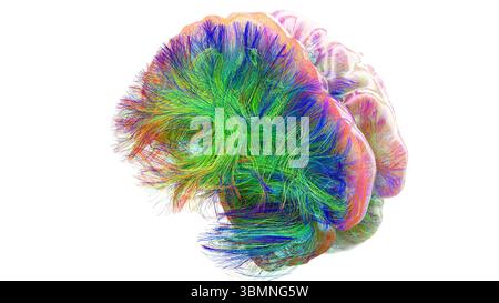 Illustration of a high-resolution brain tractogram, depicting the ...