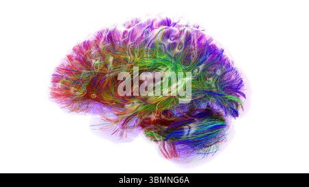 Illustration of a high-resolution brain tractogram, depicting the ...