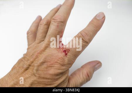 Cut and bleeding male hand on a white Stock Photo - Alamy