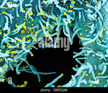 Colorized electron microscope image of yellow fever virus ...