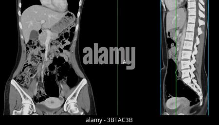 Contrast-enhanced CT whole abdomen study revealing normal anatomical ...