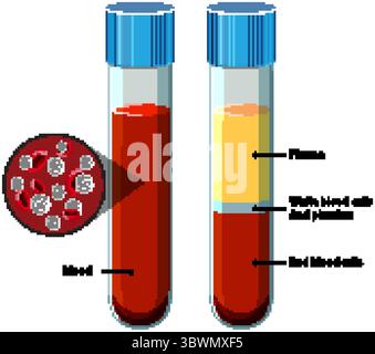 Blood components. Red and white blood cells, plasma, platelets ...