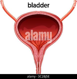 Human bladder cross-section with urinary stones outline illustration ...