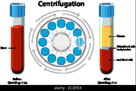 Blood after separation of platelets in the centrifuge in test tube, PRP ...