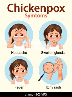Vector illustration of chickenpox symptoms in child, cartoon style ...