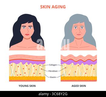 Aging process. Face skin structure changes. cross section diagram ...