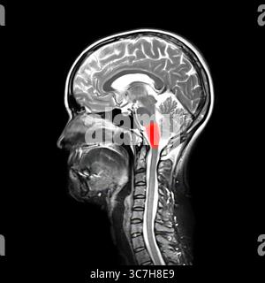 MRI or Magnetic Resonance Imaging Illustration with Doctor and Patient ...