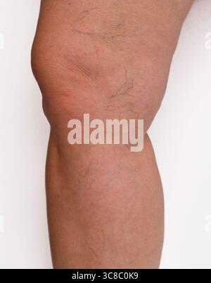 Ultrasound vascular diagnostics. Leg venous ultrasound Stock Photo - Alamy