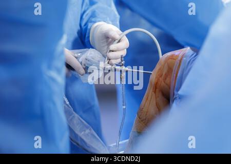 Surgeons perform knee arthroscopy with PCL reconstruction using ...
