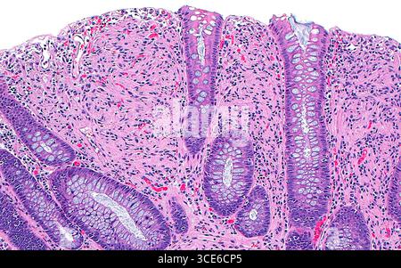 Light microscopy of a small peripheral nerve in cross section. The ...