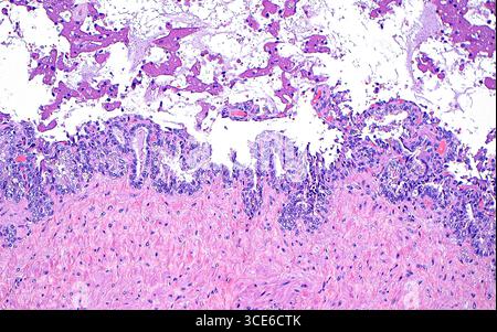 Seminal vesicle, light micrograph Stock Photo - Alamy