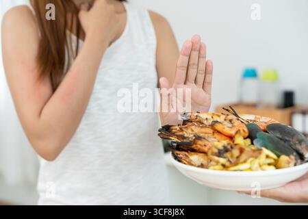 food allergies, hand confused eating shrimp, seafood allergy, itching ...