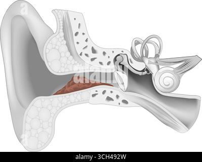 Earwax. Cross section of a human ear with Cerumen in External auditory ...