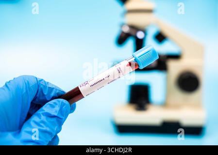 Transferrin test. Measures transferrin levels, a protein that ...