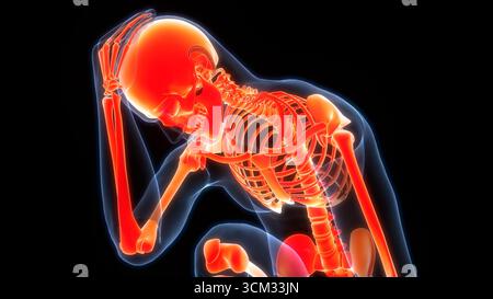Human Suffering with Severe Headache Anatomy Stock Photo - Alamy
