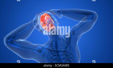 Human Suffering with Severe Headache Anatomy Stock Photo - Alamy