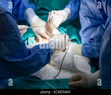 Surgeons performing cesarean section in operating room. Birth surgery ...