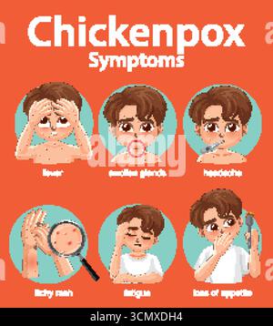 Vector illustration of chickenpox symptoms in child, cartoon style ...