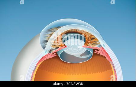 Intraocular lens implantation, illustration Stock Photo - Alamy