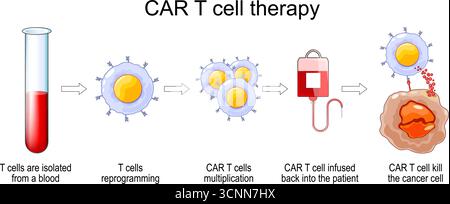CAR T-cell therapy. cancer immunotherapy. killing of tumor cells ...