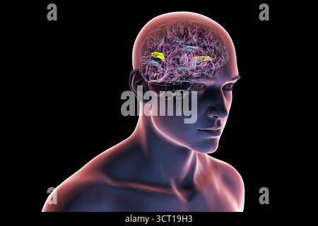 Illustration of the human brain with the transverse temporal gyri ...