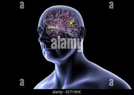 Illustration of the human brain with the transverse temporal gyri ...