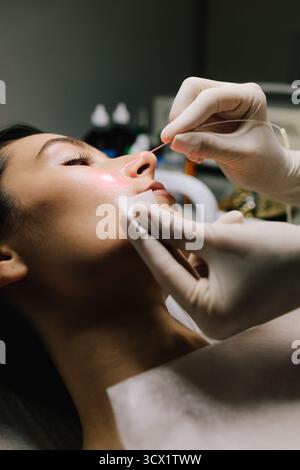 Aesthetic laser removal of nevi and benign growths. Dermatologist ...