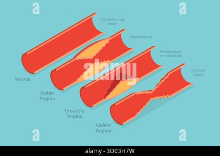 3D Isometric Flat Illustration of Types Of Synovial Joints, Labeled ...