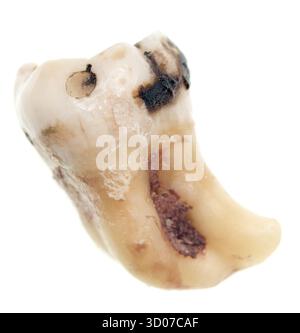 Wisdom tooth isolated on white background Stock Photo - Alamy