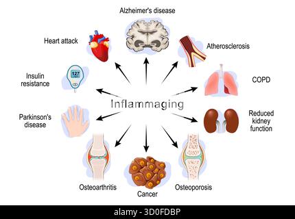 Inflammaging. Hallmarks of ageing. Chronic inflammation that develops ...