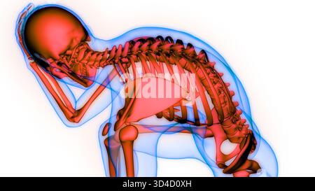 Human Suffering with Severe Headache Anatomy Stock Photo - Alamy