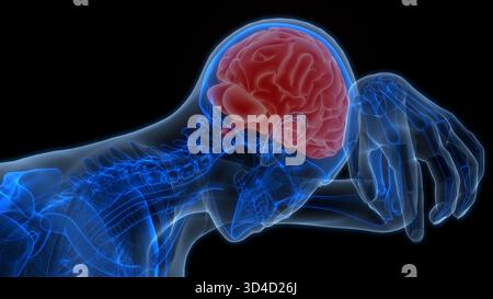 Human Suffering with Severe Headache Anatomy Stock Photo - Alamy