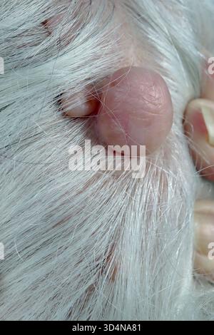 Neurofibroma on the skin of a 70-year-old man. Neurofibroma growths ...