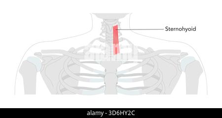 Neck muscle chart, infrahyoid sternohyoid, sternothyroid, thyrohyoid ...