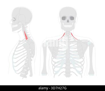 Posterior scalene - neck muscle shown raising the second rib, also ...