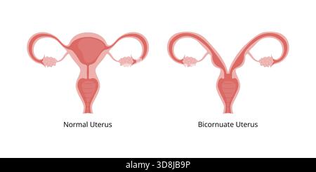 Human female reproductive system with uterus and ovaries illustration ...
