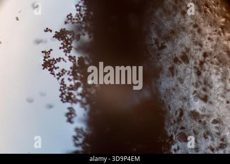 High-Power Photomicrograph Revealing Multicellular Dematiaceous Fungal ...