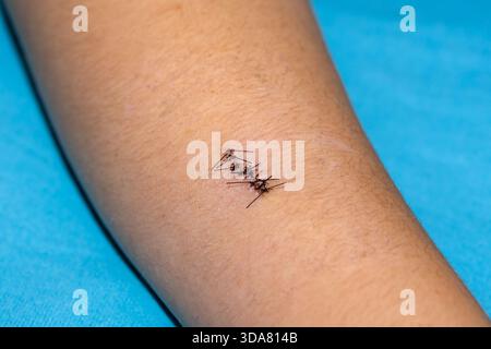Black surgical sutures before their removal from the wound. Close up of ...