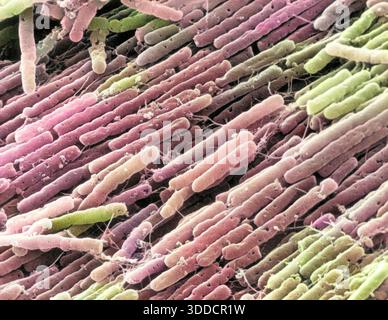 Clostridium bacteria, SEM, under the microscope Stock Photo - Alamy