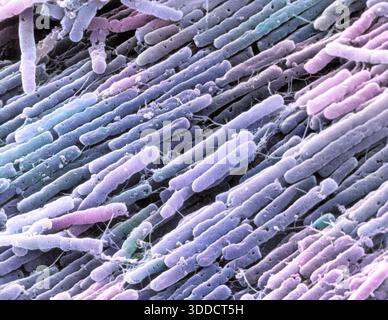 Scanning electron micrograph (SEM) of Clostridium botulinum spores ...