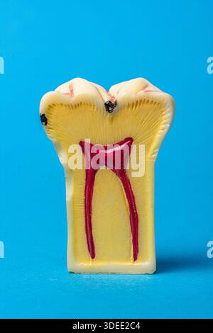 Dental molar cross section model showing enamel, dentin, pulp and an ...