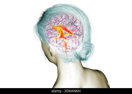 Ventricular system. Human brain with ventricles and Cerebrospinal fluid ...