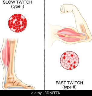 Slow twitch and fast twitch muscle fiber types illustration Stock ...