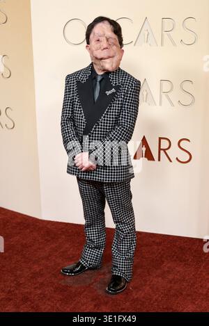 Adam Pearson at the 98th Annual Academy Awards held at Dolby Theatre in ...